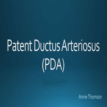 Patent ductus arteriosus | PPT