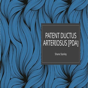 Patent ductus arteriosus [PDA], shane stanley.pptx