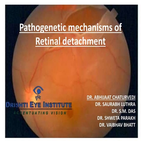 Pathogenetic mechanism of Retinal Detachment | PPTX