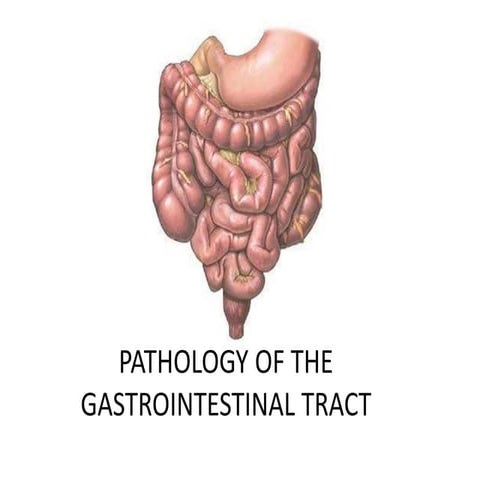 Pathologies of the gastrointestinal tract | PPTX