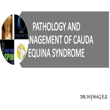 PATHOLOGY AND MANAGEMENT OF CAUDA EQUINA SYNDROME DR INYANG.pptx