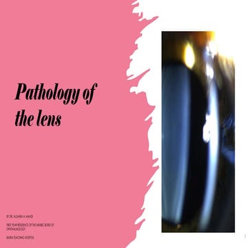 A short dive into the patholpgy of the human lens and how to reach it ...