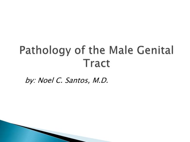 Pathology of the male genital tract | PPTX Pathology of the male genital tract | PPTX