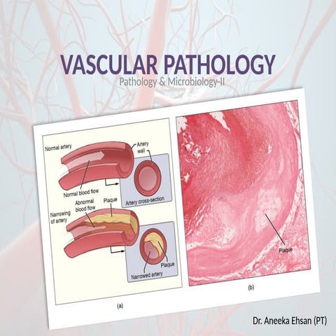 Vascular pathology/ Blood vessels diseases.pptx