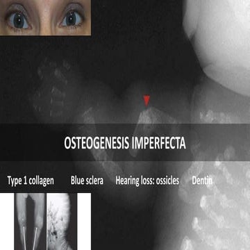 Bone Pathology snaps | PPTX