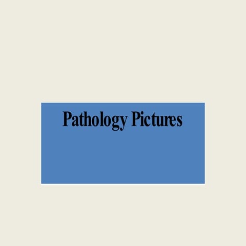 Pathology Titled | PPT