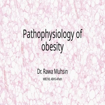 Pathophysiology of obesity - Rawa Muhsin | PPTX