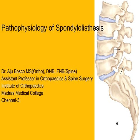 Transitional vertebrae radiology | PPTX