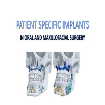 Patient Specific Implants Pptx