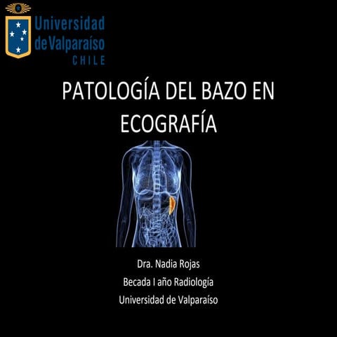 PATOLOGÍA DEL BAZO EN ECOGRAFÍA. | PPT