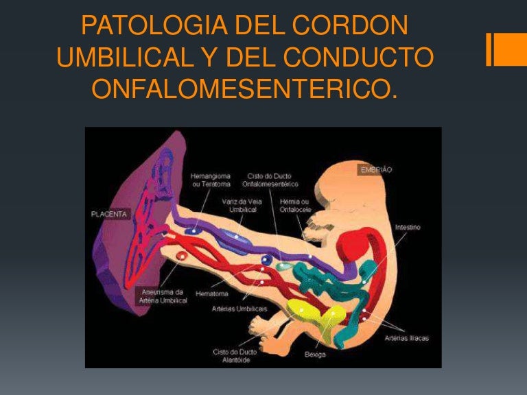 Patologia del cordon y persistencia del uraco PEDIATRIA
