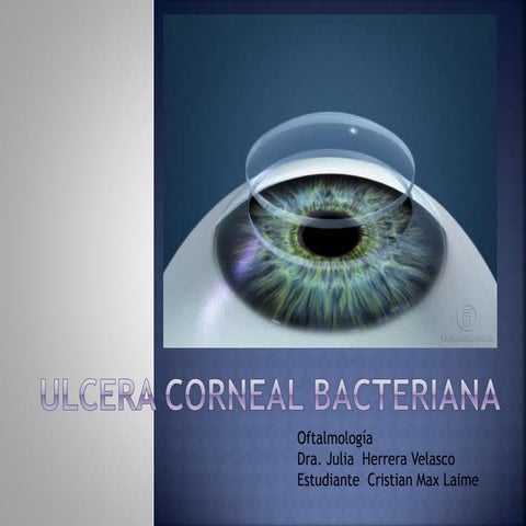 ulceras corneales bacterianas | PPTX