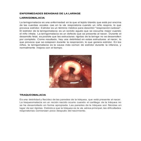 Patologias de la voz | DOCX