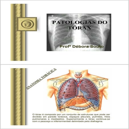 Anatomia tomografica do torax | PDF