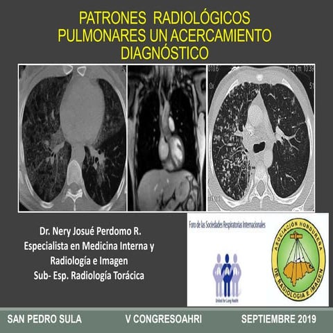 Tac Torax Patron Nodular