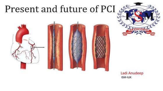When and Where? Hybrid Procedure after Percutaneous Coronary ...