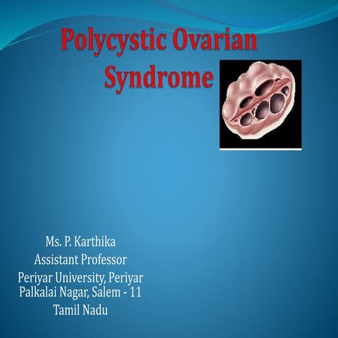 PCOD | PPTX