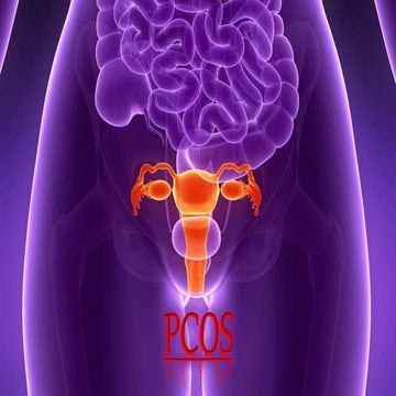 PCOS (polycystic ovarian syndrome) | PPTX
