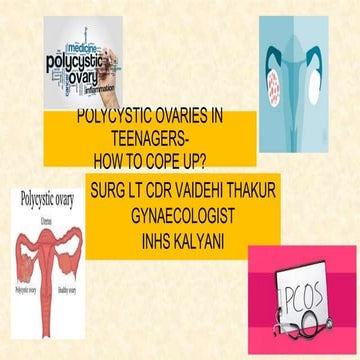 Polycystic Ovarian and Syndrome | PPT