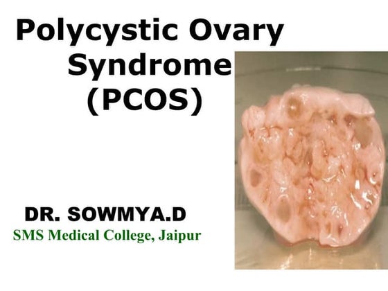 PCOS POLY CYSTIC OVARIAN SYNDROME-OBG.pptx