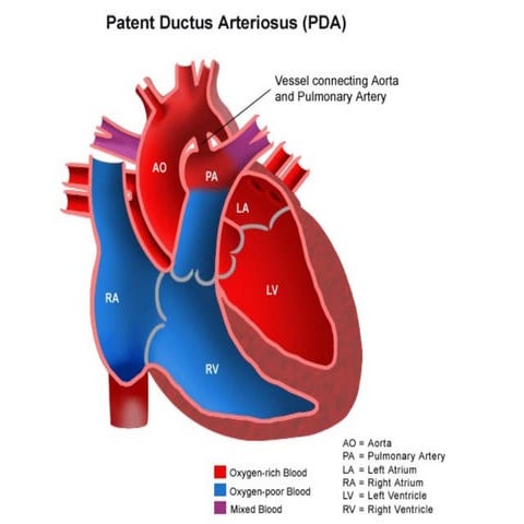 Pda Part 1 Introduction Ppt