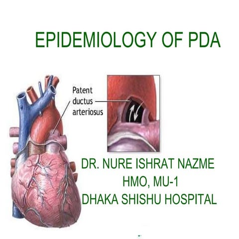 Pda Part 2 Epidemiology | PPT