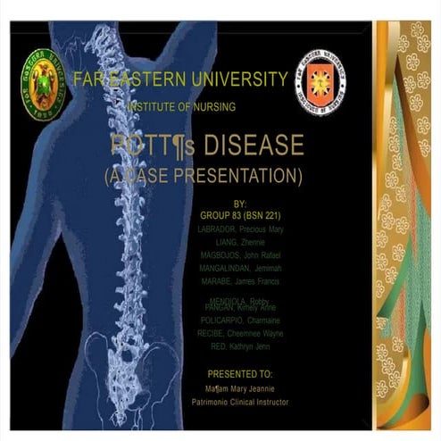 Pott disease TB vertebrae jvjgjgigiggigu | PPT