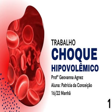 Choque hipovolêmico | PPT