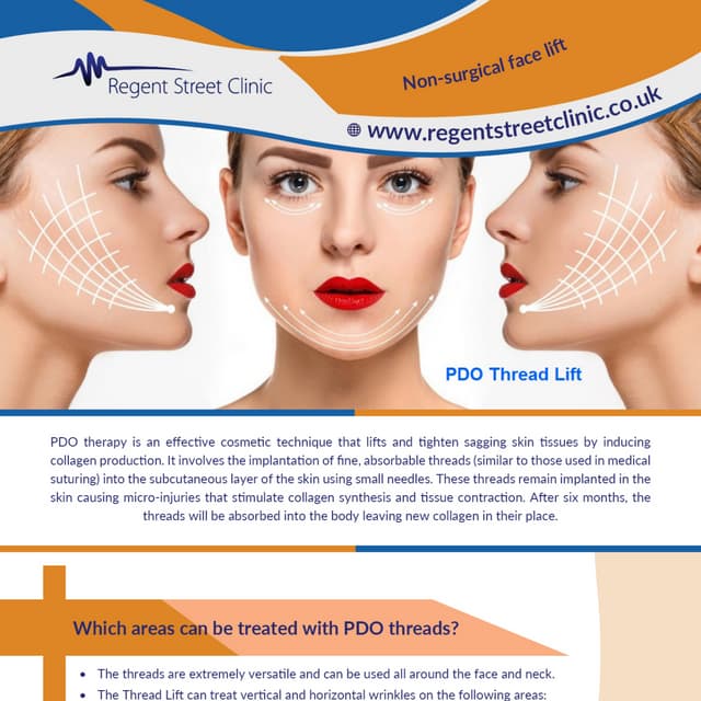 Pdo thread lift | PDF