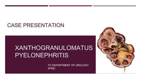 QOUSAIN APPENDICITIS.pptx