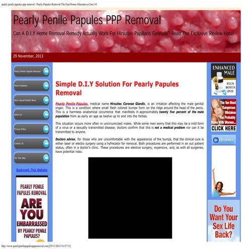 pearly papules removal the fast home alternative cure | PDF | Sexual Conditions | Sexual Health