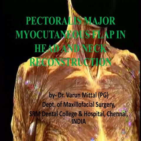 Pectoralis Major Myocutaneous Flap in Head and Neck Reconstruction | PPTX