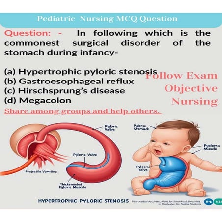 Pediatric Nursing MCQ Question|Nursing MCQ Set-78| | PDF