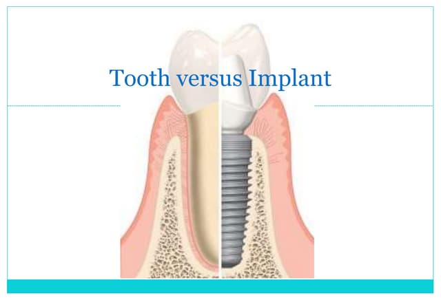 Selective grinding | PPTX
