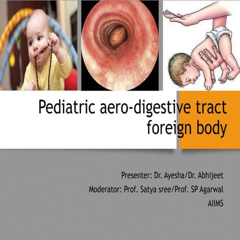 Pediatric airway foreign body | PPT