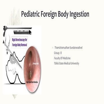 Pediatric foreign body ingestion | PPTX