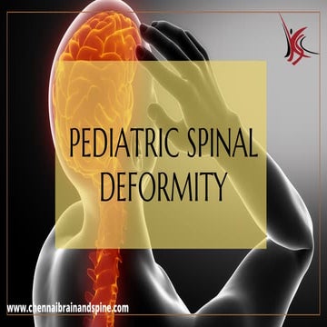 Pediatric spinal deformity | PDF