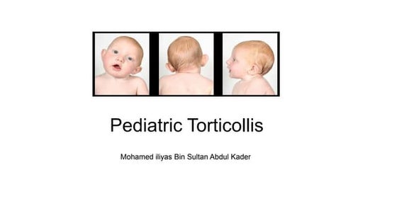 Torticollis | DOCX | Thyroid Disorders | Endocrine and Metabolic Diseases