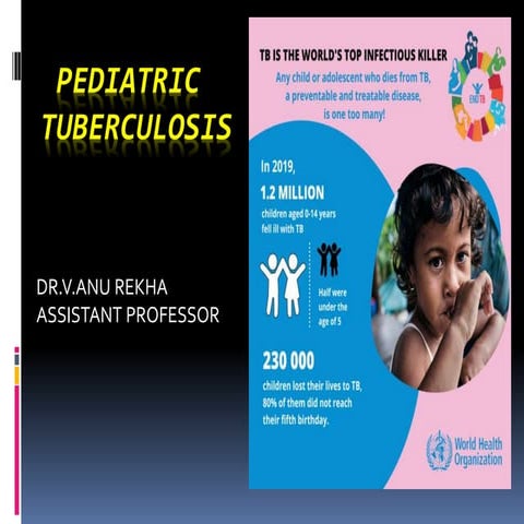 Pediatric tuberculosis dr. anu | PPT