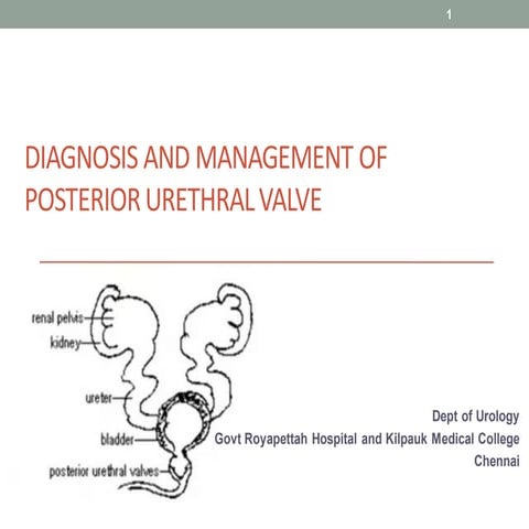 Pediatric urology :Posterior Urethral Valve (PUV)- diagnosis & management | PPT