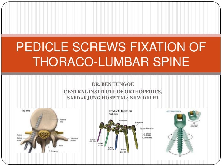 Pedicle Screws Fixation of Thoraco-Lumbar Spine