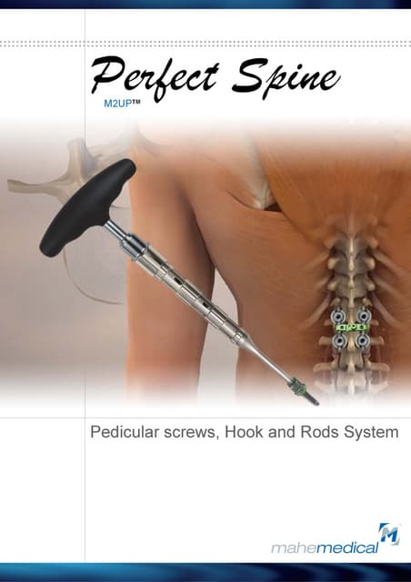 pedicle screw insertion | PPTX