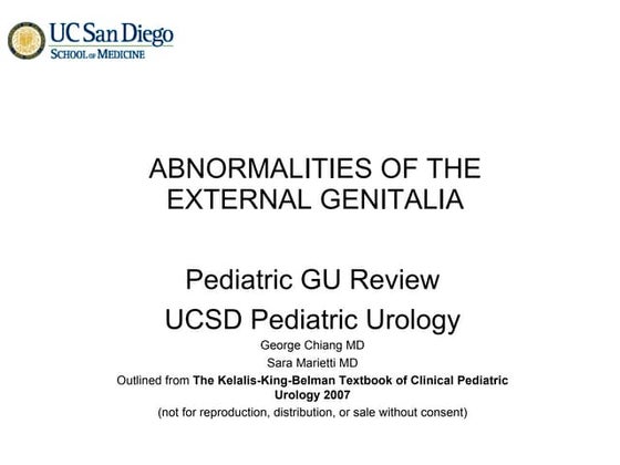 Cryptorchidism | PPTX