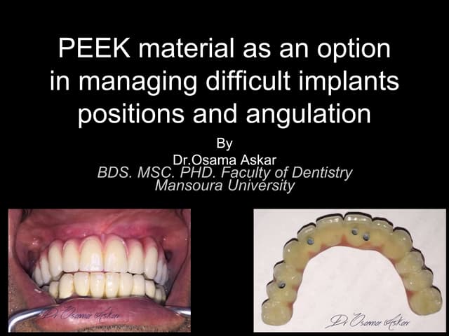 Peek dental material advantages | PPTX