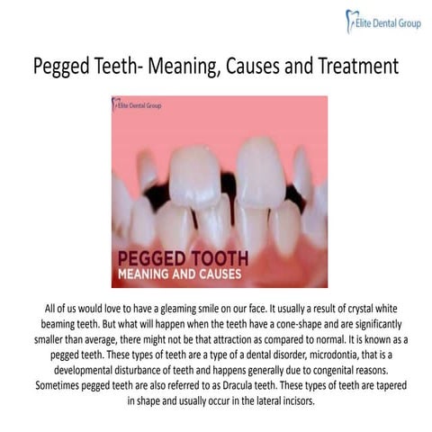 PEGGED TEETH- MEANING, CAUSES AND TREATMENT | PPTX