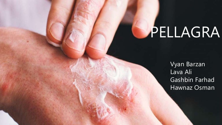 Pellagra