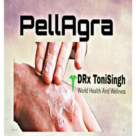Pellagra | PPT