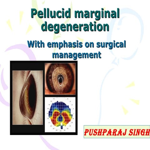 Pellucid marginal degeneration | PPT