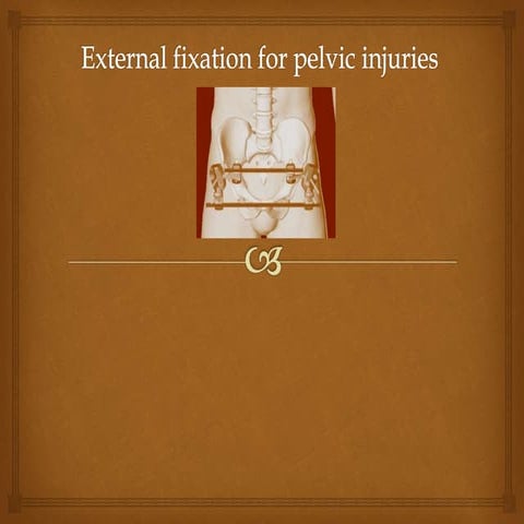 Pelvic ex fix | PPTX