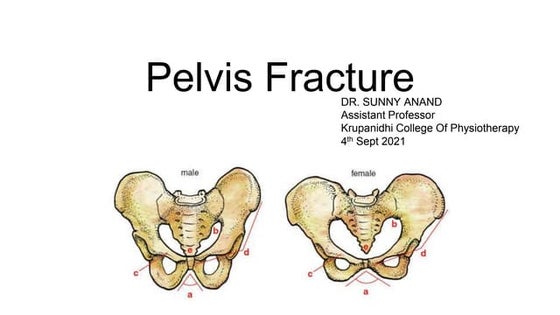 FRACTURES OF THE PELVIS-1.ppt